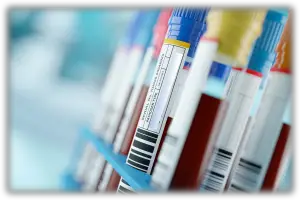 Comprehensive Guide to Rheumatoid Arthritis for NCLEX Questions: Causes ...